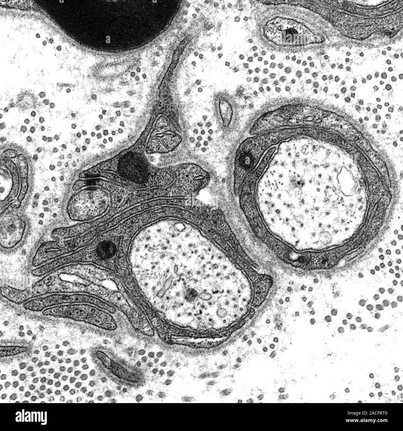 Unmyelinated nerve. Transmission electron micrograph (TEM) of a section ...