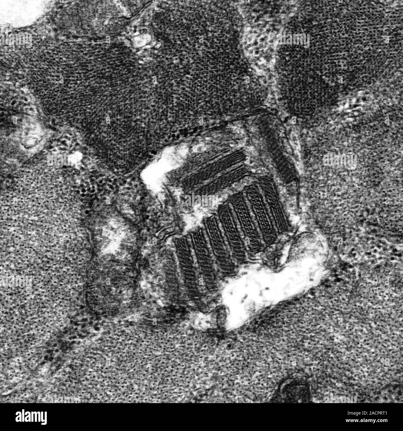 Mitochondrial inclusions. Transmission electron micrograph (TEM) of a ...