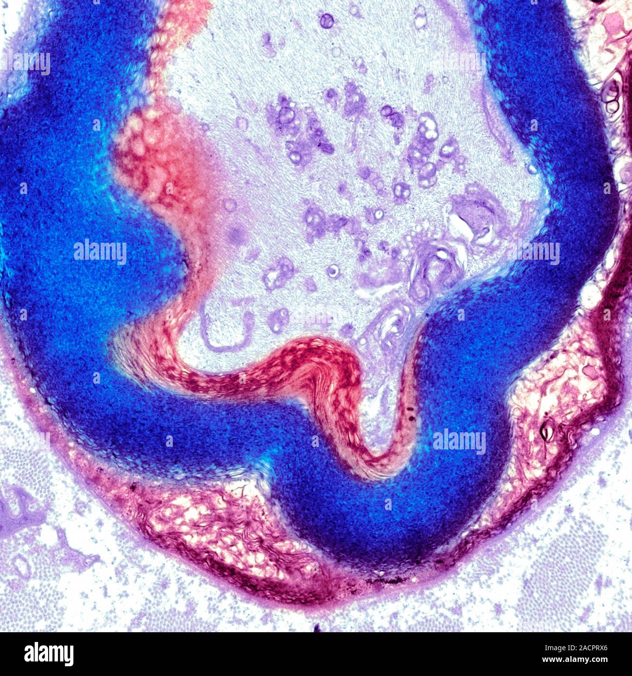 Myelinated nerve. Coloured transmission electron micrograph (TEM) of a section through a ...