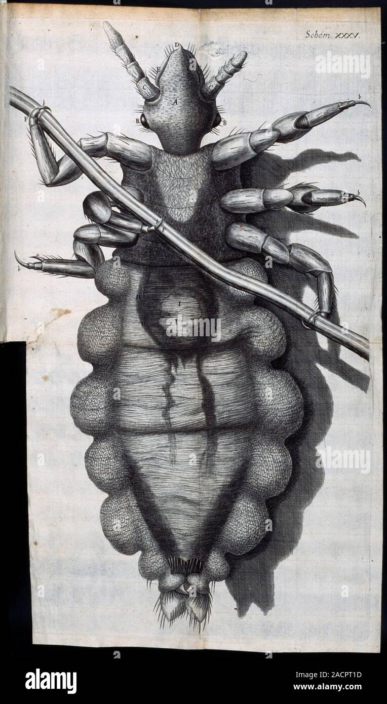 Louse. 17th-century artwork of the underside of a louse clinging to a ...