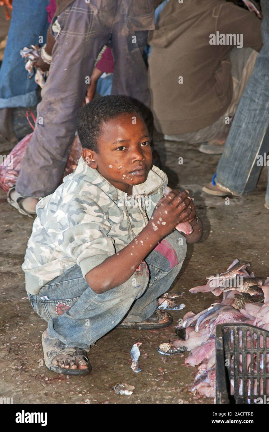 Fish market, Ethiopia. Young boy using his teeth to skin Tilapia sp ...