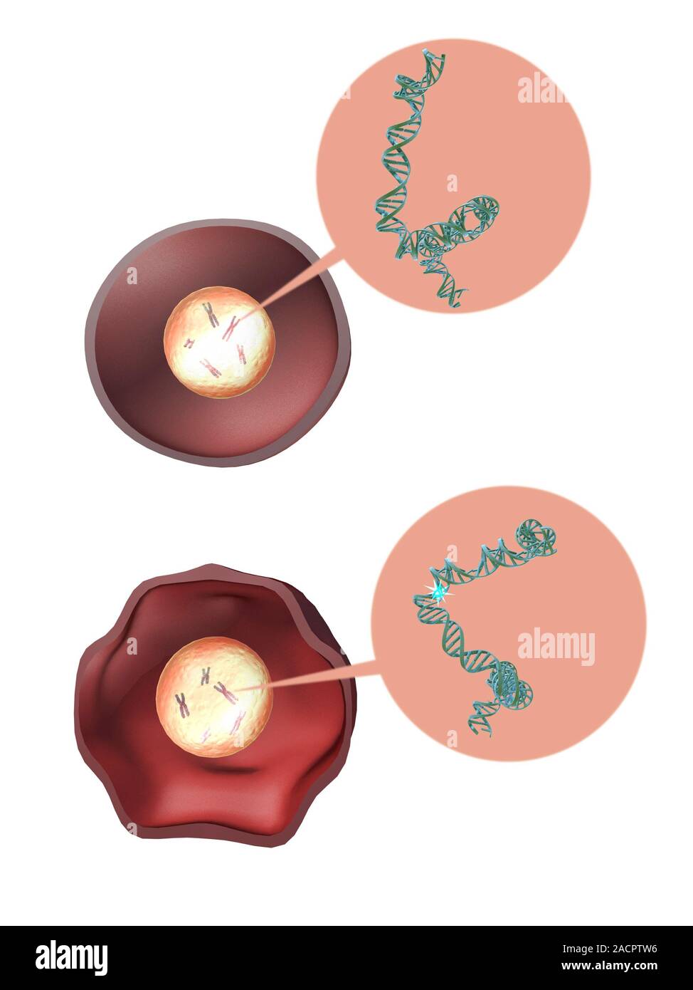 Oncogenes. Computer artwork comparing the DNA (deoxyribonucleic acid ...