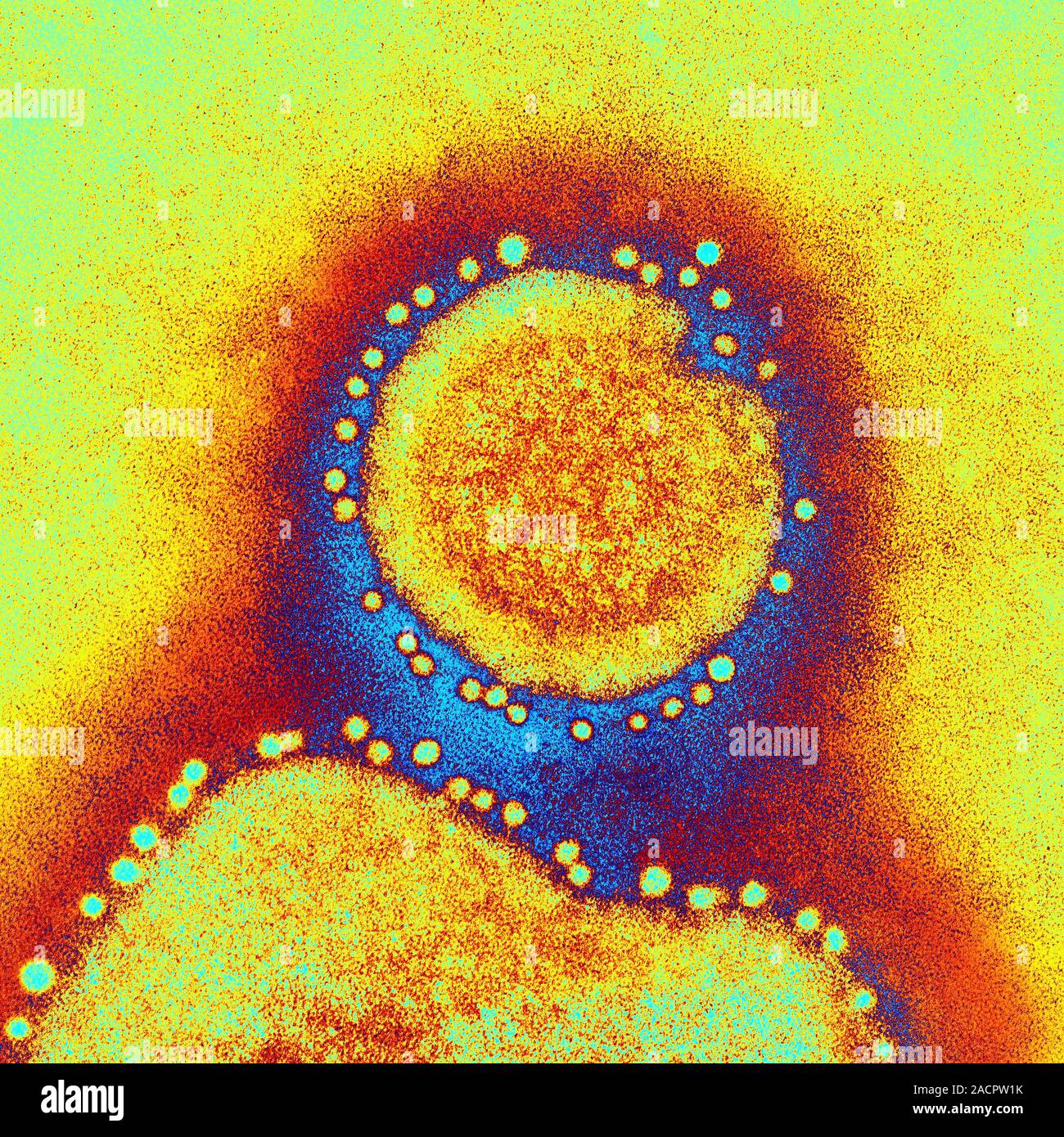 Avian influenza virus, type A strain H7N9, coloured transmission ...