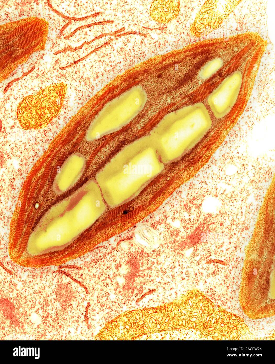 Chloroplast. Coloured transmission electron micrograph (TEM) of ...