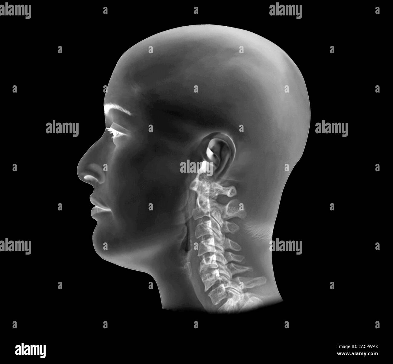 Normal neck. X-ray of a 35 year old patient's healthy cervical (neck ...