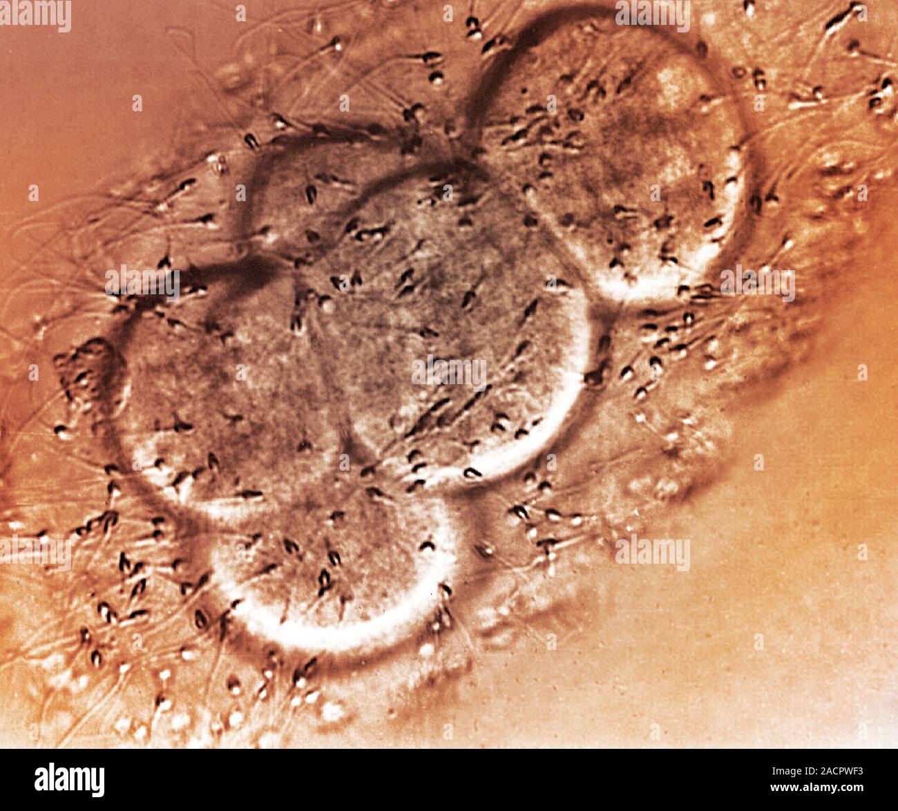 IVF treatment. Light microscope of human egg cells (large, round) and ...