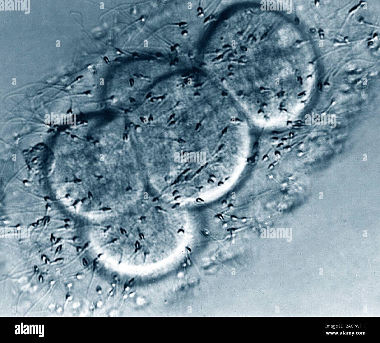 IVF treatment. Light microscope of human egg cells (large, round) and ...