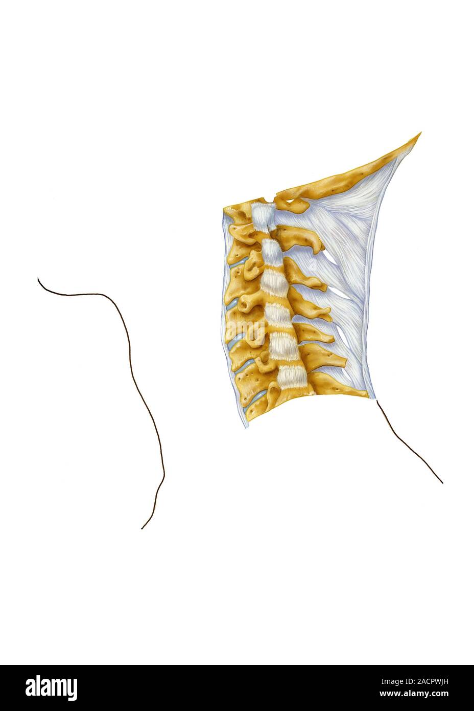Vertebral joints of the neck. Artwork of the bones (yellow) and ...