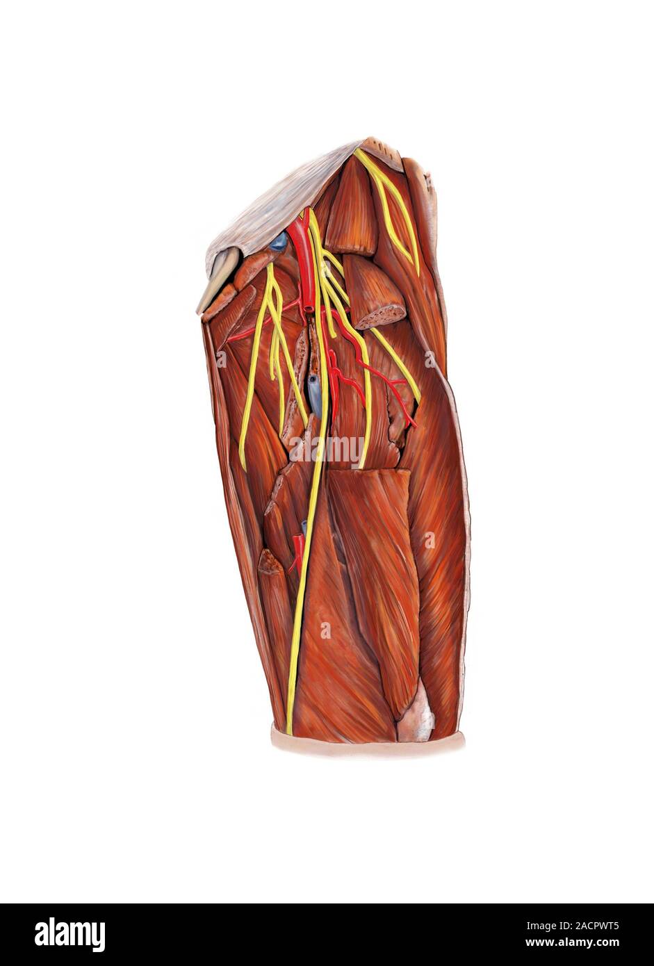 Thigh nerve plexus. Artwork of the nerves (yellow), arteries (red ...