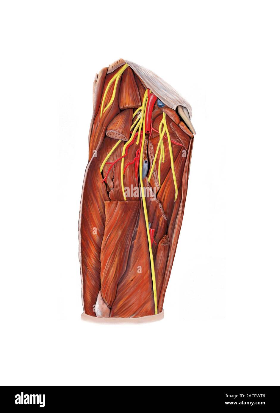 Thigh nerve plexus. Artwork of the nerves (yellow), arteries (red ...