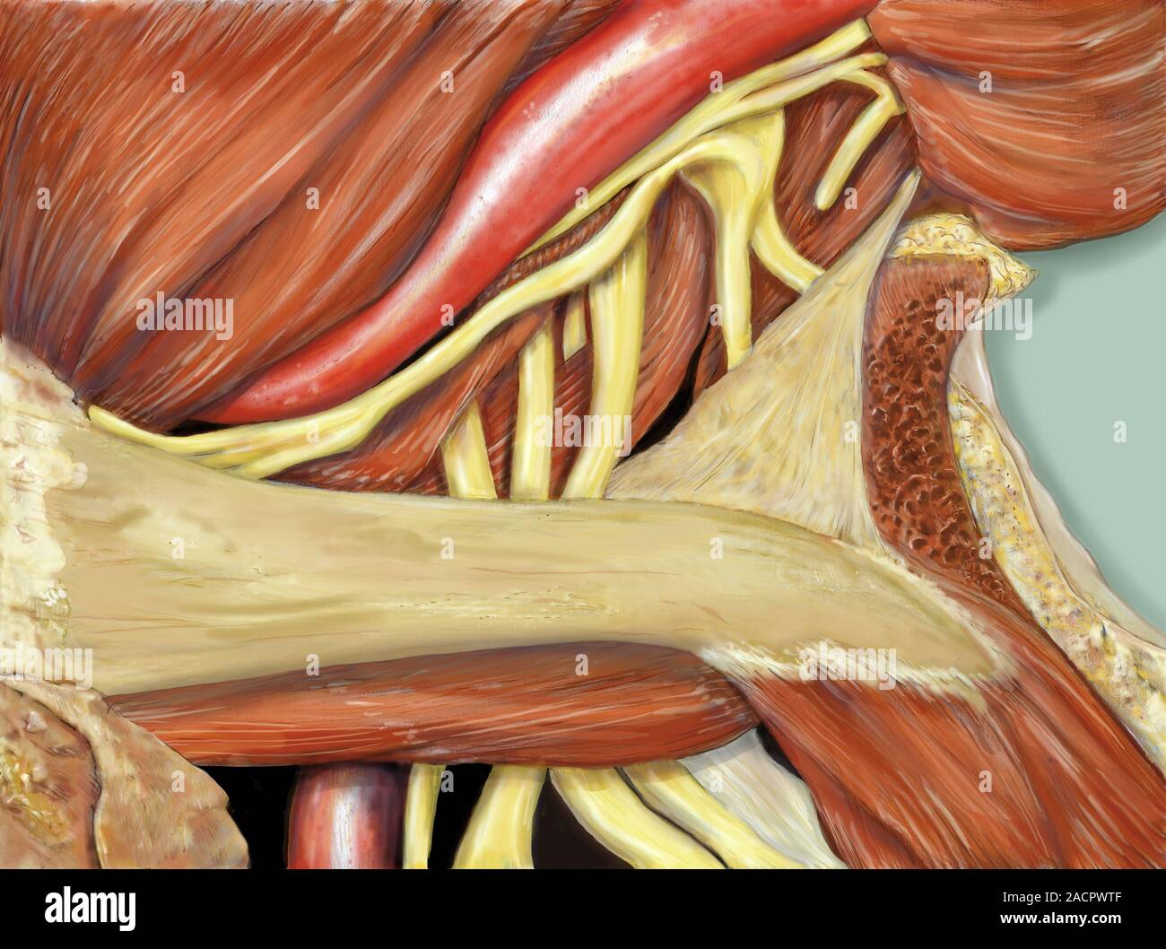 Left shoulder nerve plexus. Artwork of the nerves (yellow), arteries ...