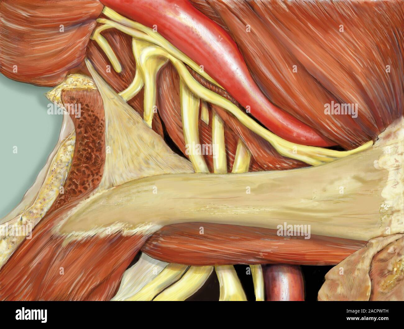 Right shoulder nerve plexus. Artwork of the nerves (yellow), arteries ...