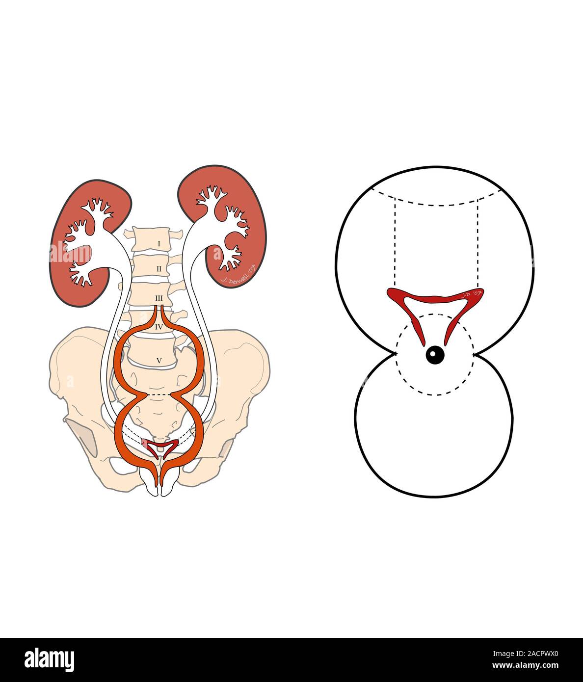 Incontinence surgery. Artwork of the sacral region of a woman's pelvis ...