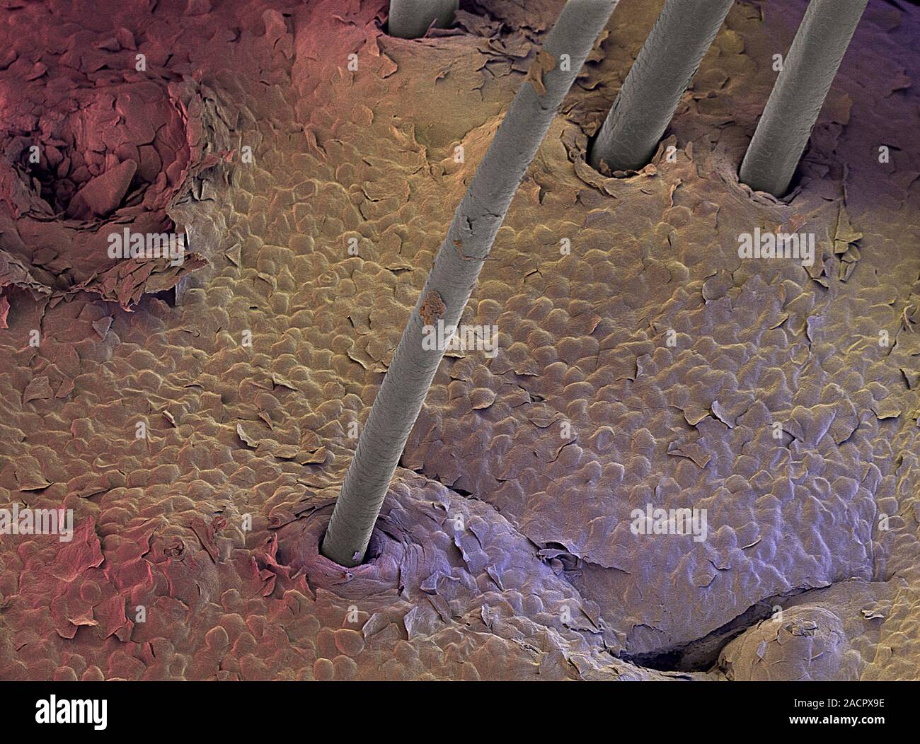 Human skin. Coloured scanning electron micrograph (SEM) of human skin ...