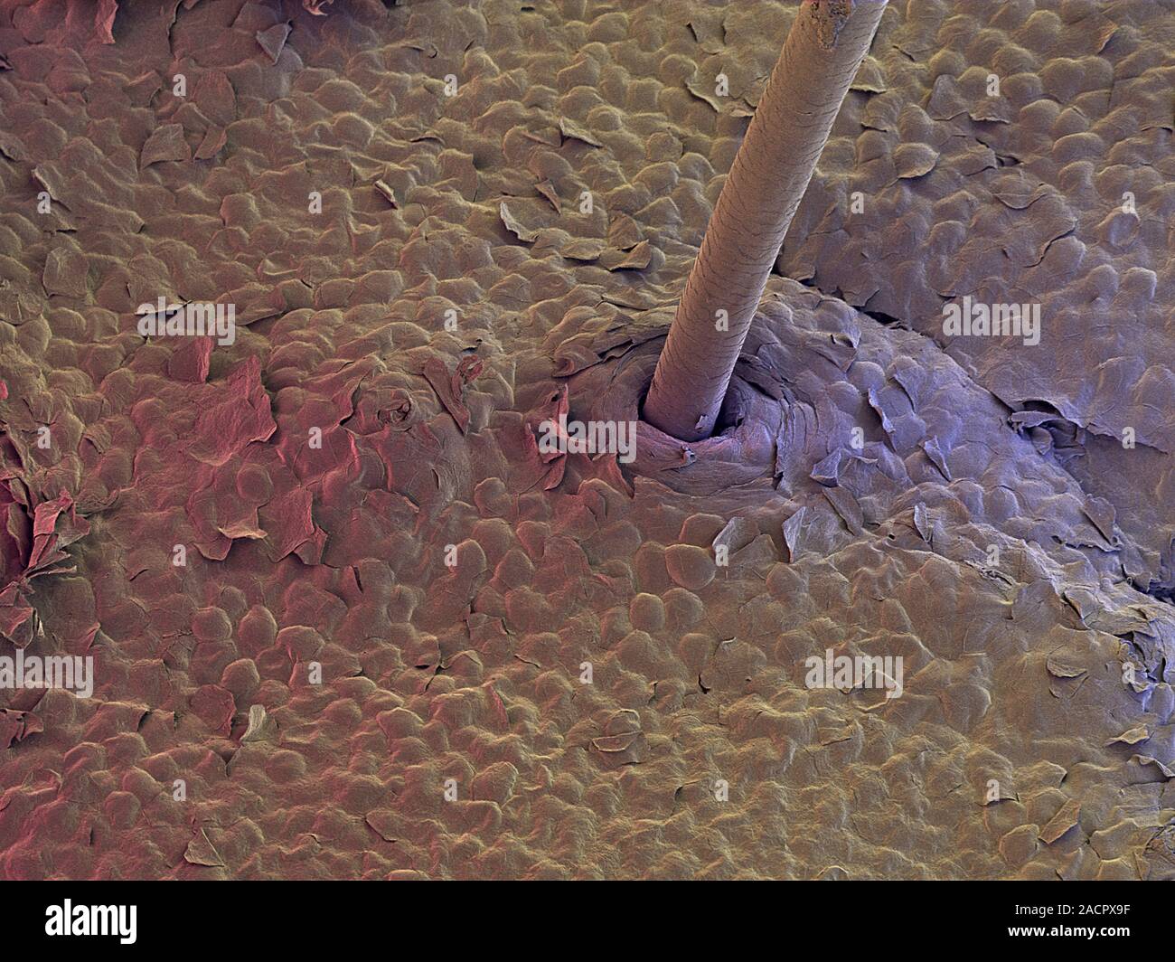 Human skin. Coloured scanning electron micrograph (SEM) of human skin ...