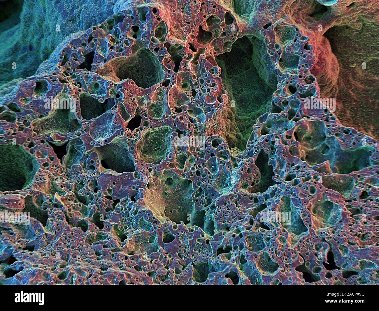 Volcanic ash. Coloured scanning electron micrograph (SEM) of ash ...
