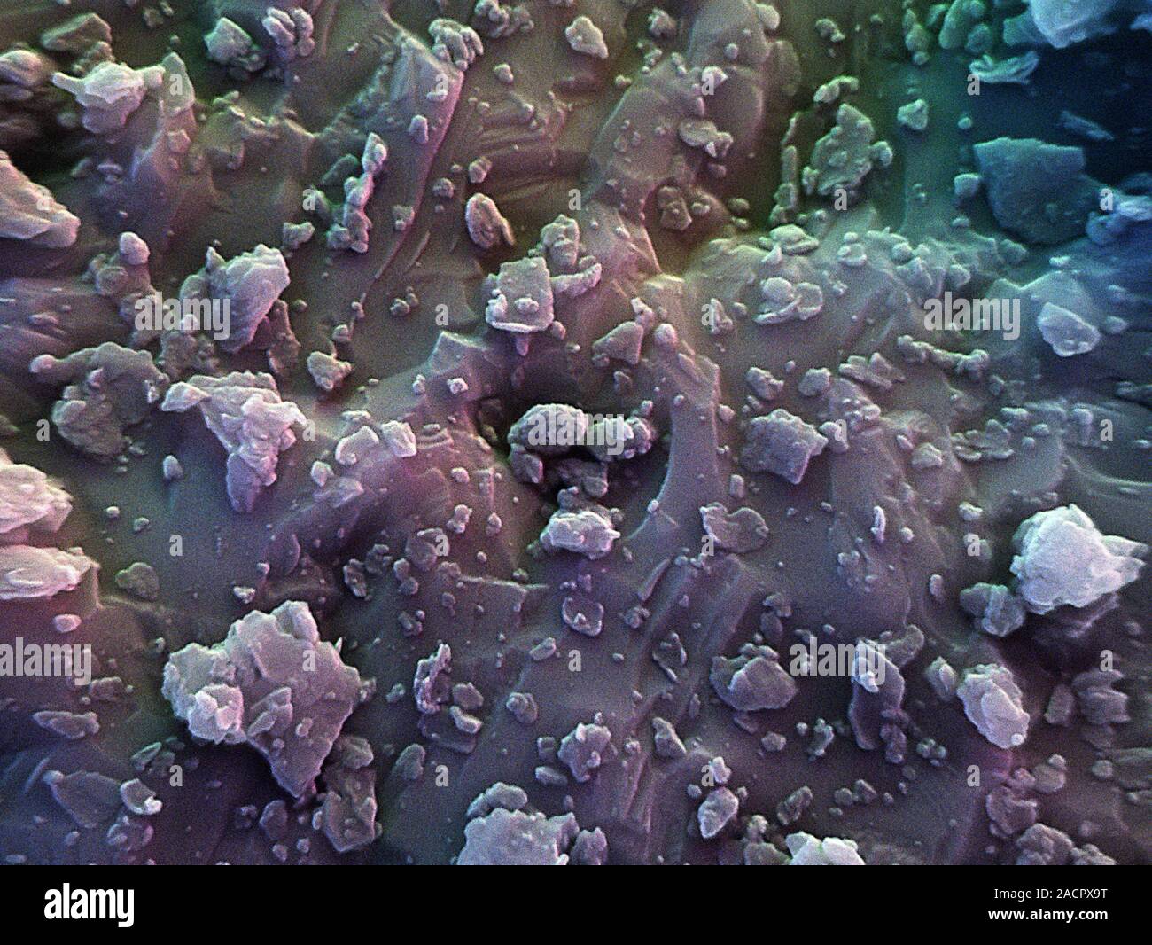 Bottom ash. Coloured scanning electron micrograph (SEM) of coal bottom ...