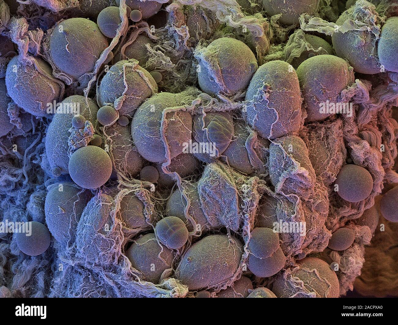 Fat tissue. Coloured scanning electron micrograph (SEM) of a sample of ...