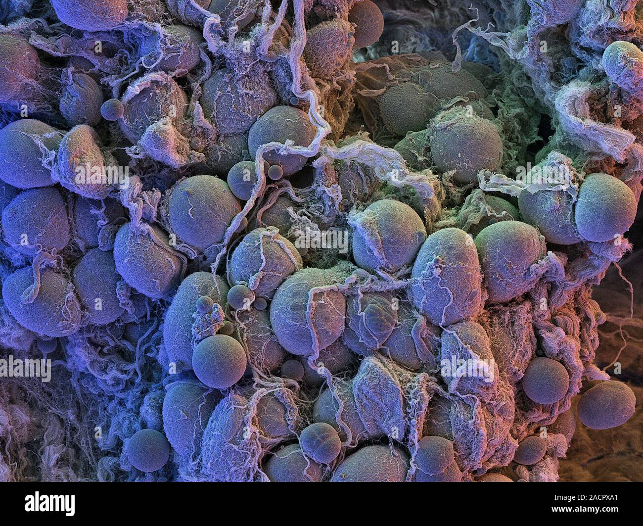Fat tissue. Coloured scanning electron micrograph (SEM) of a sample of ...