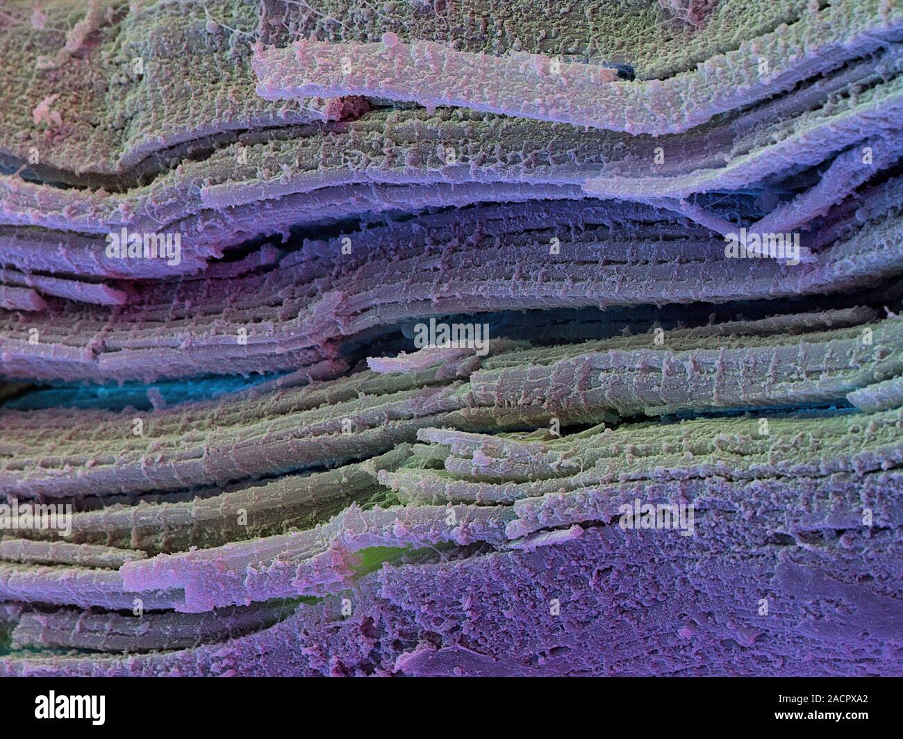 Skeletal muscle fibres. Coloured scanning electron micrograph (SEM) of a bundle of skeletal ...