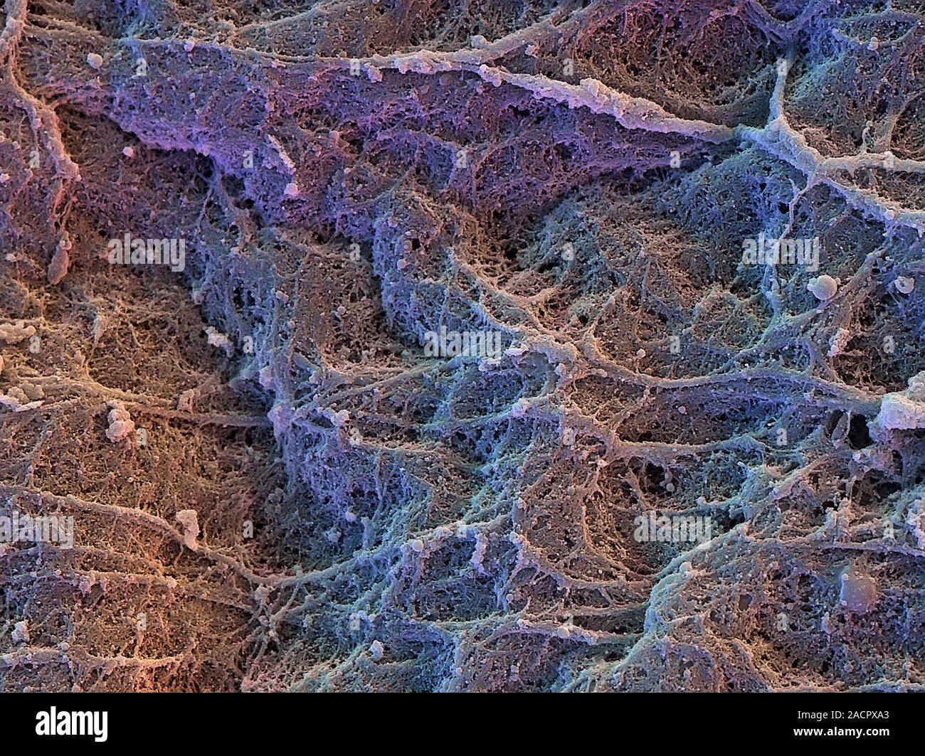 Hyaline cartilage. Coloured scanning electron micrograph (SEM) of hyaline cartilage from a ...