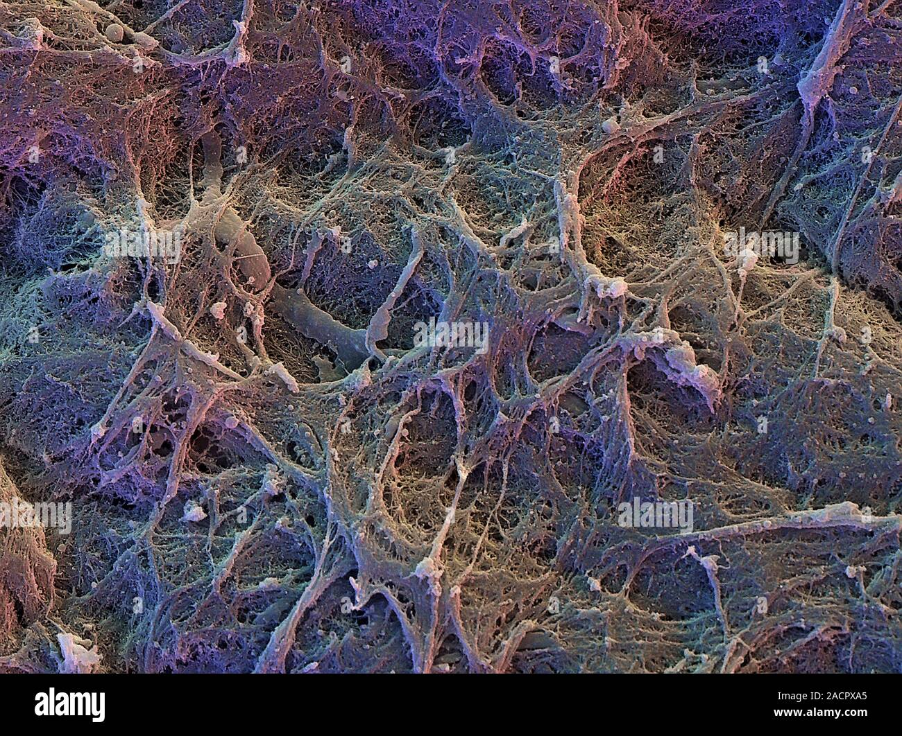 Hyaline cartilage. Coloured scanning electron micrograph (SEM) of hyaline cartilage from a ...