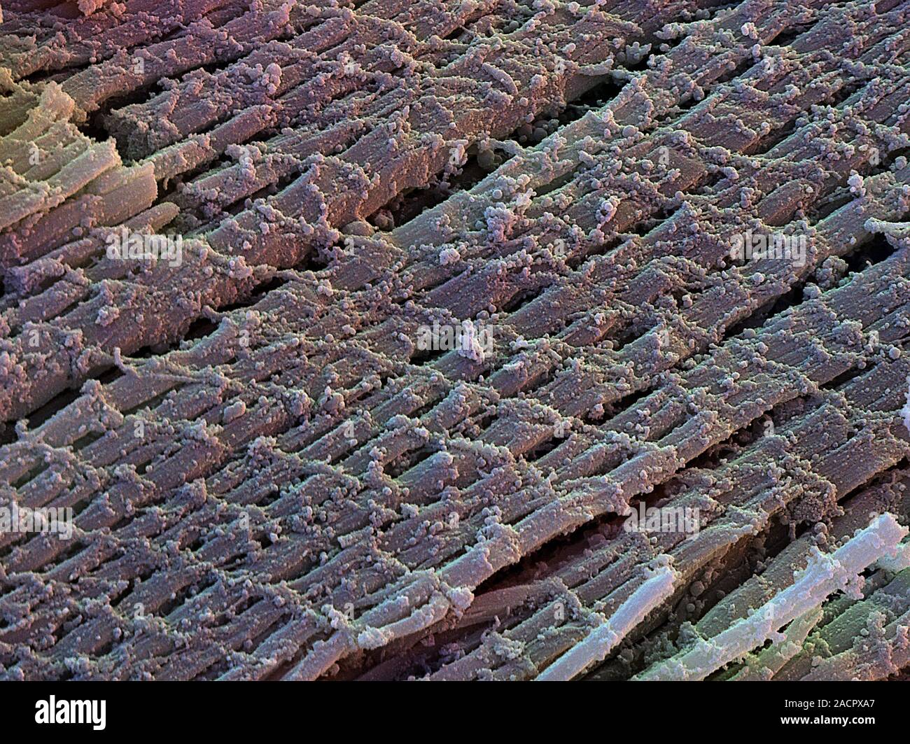 Skeletal muscle fibres. Coloured scanning electron micrograph (SEM) of a bundle of skeletal ...