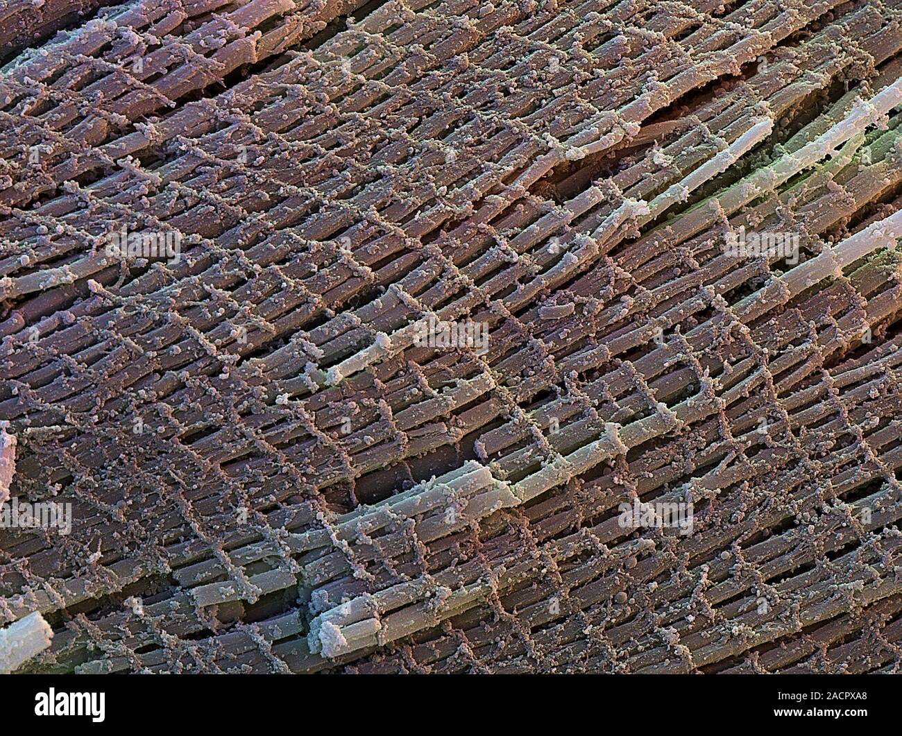 Skeletal muscle fibres. Coloured scanning electron micrograph (SEM) of a bundle of skeletal ...