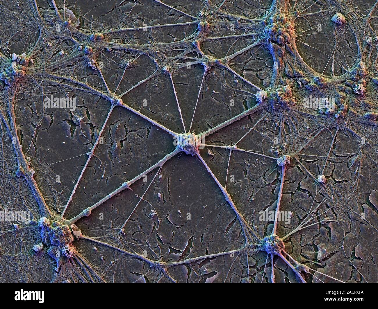 Brain nerve cells. Scanning electron micrograph (SEM) of cortical ...