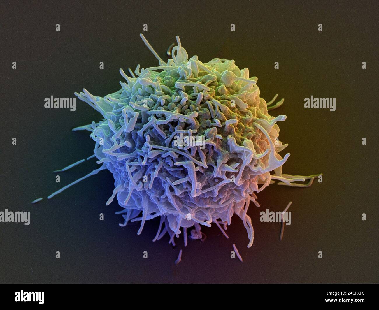 Lymphoblast white blood cell. Coloured scanning electron micrograph ...