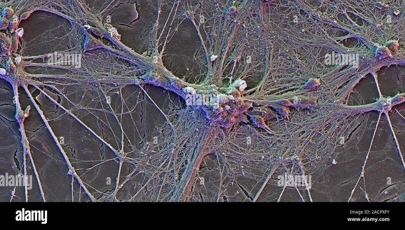 Brain nerve cells. Scanning electron micrograph (SEM) of cortical ...