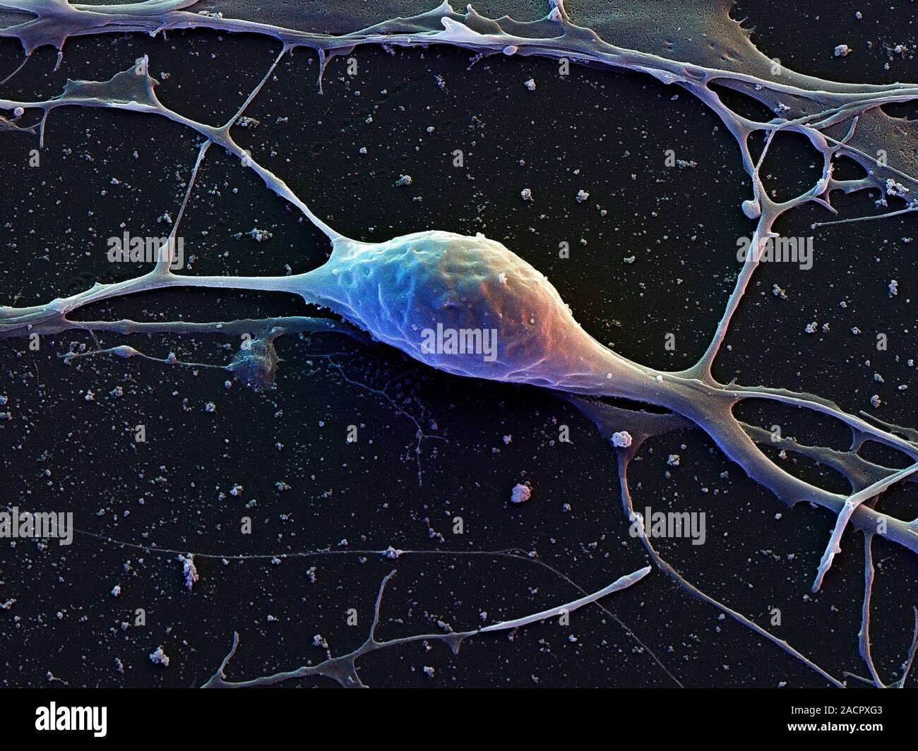 Brain cells. Scanning electron micrograph (SEM) of a cortical neuron ...