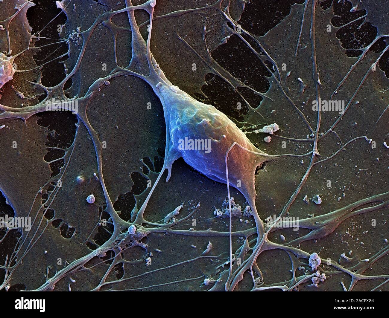 Brain cells. Scanning electron micrograph (SEM) of a cortical neuron ...
