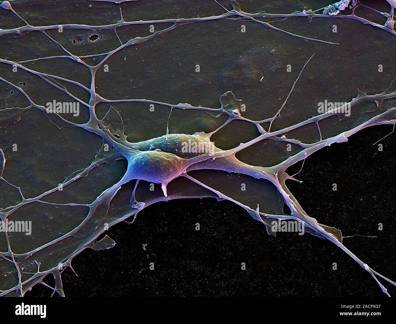 Brain cells. Scanning electron micrograph (SEM) of cortical neurons ...