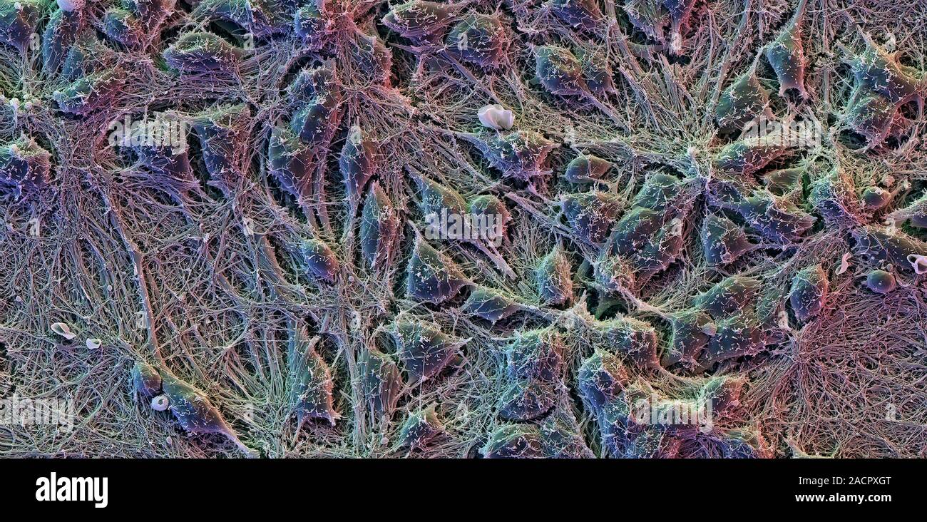 Brain nerve cells. Scanning electron micrograph (SEM) of cortical ...