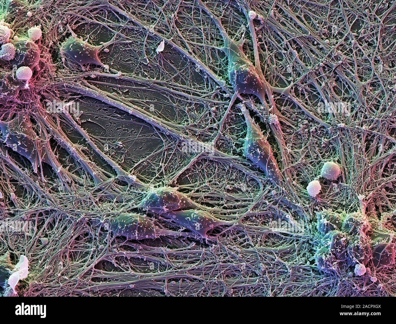 Brain nerve cells. Scanning electron micrograph (SEM) of cortical ...