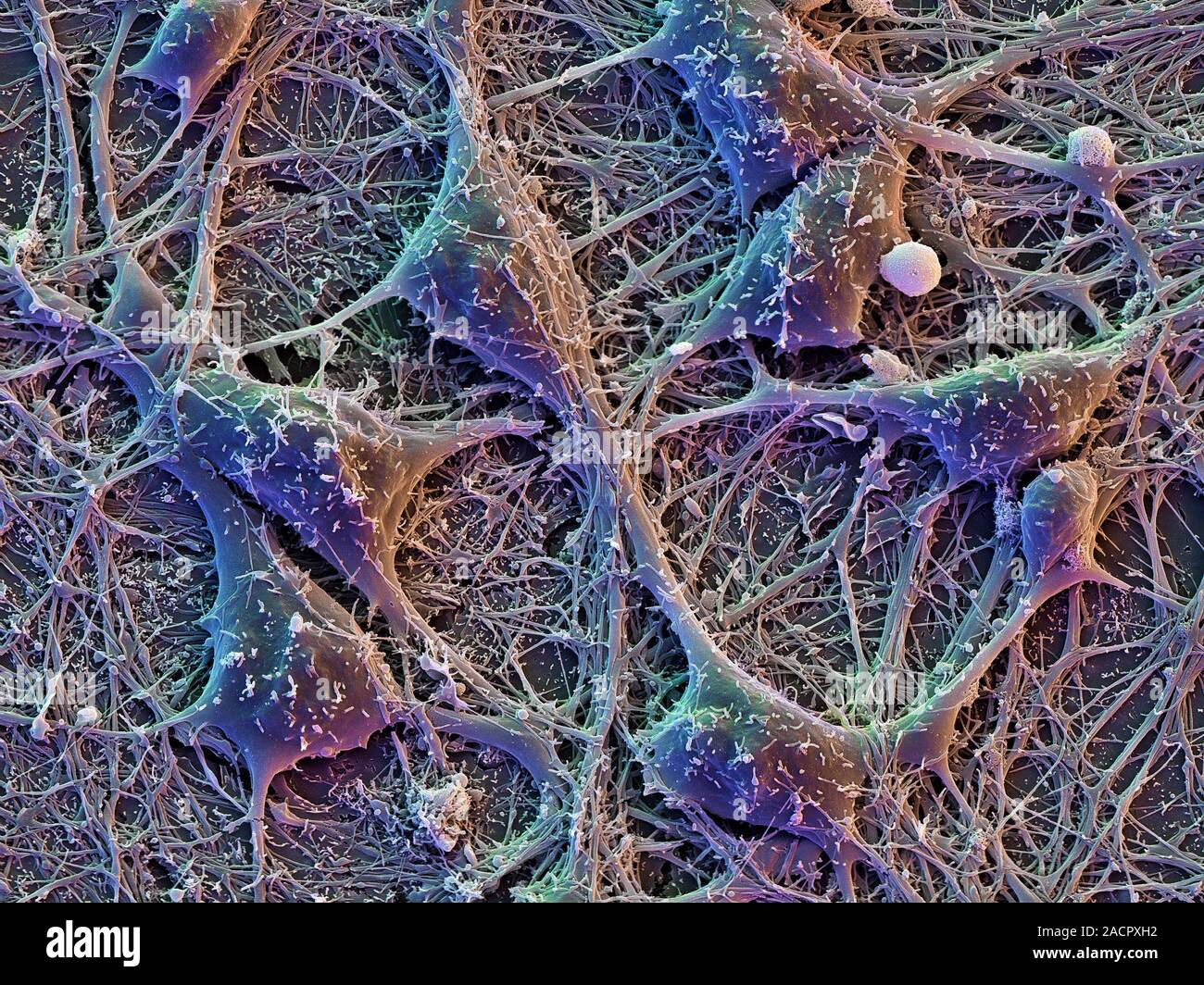 Brain nerve cells. Scanning electron micrograph (SEM) of cortical ...