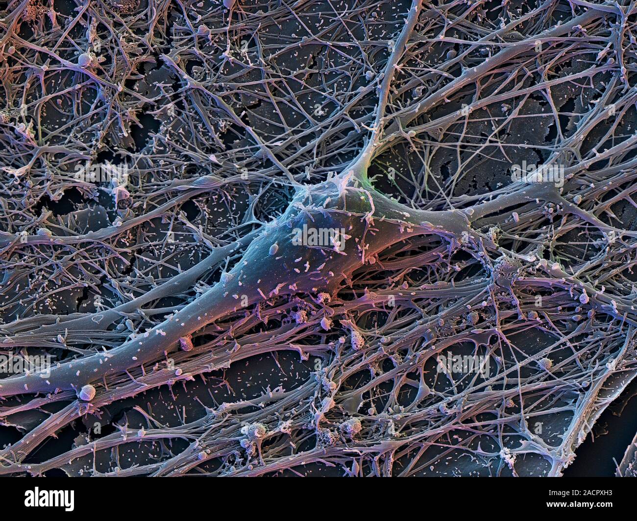Brain nerve cells. Scanning electron micrograph (SEM) of cortical ...
