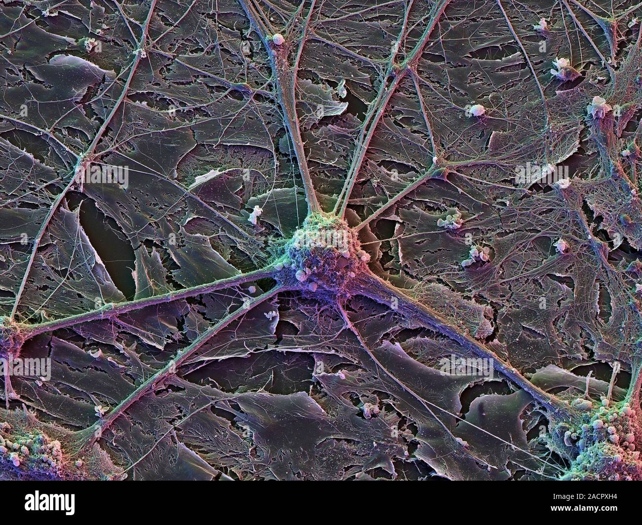 Brain nerve cells. Scanning electron micrograph (SEM) of cortical ...