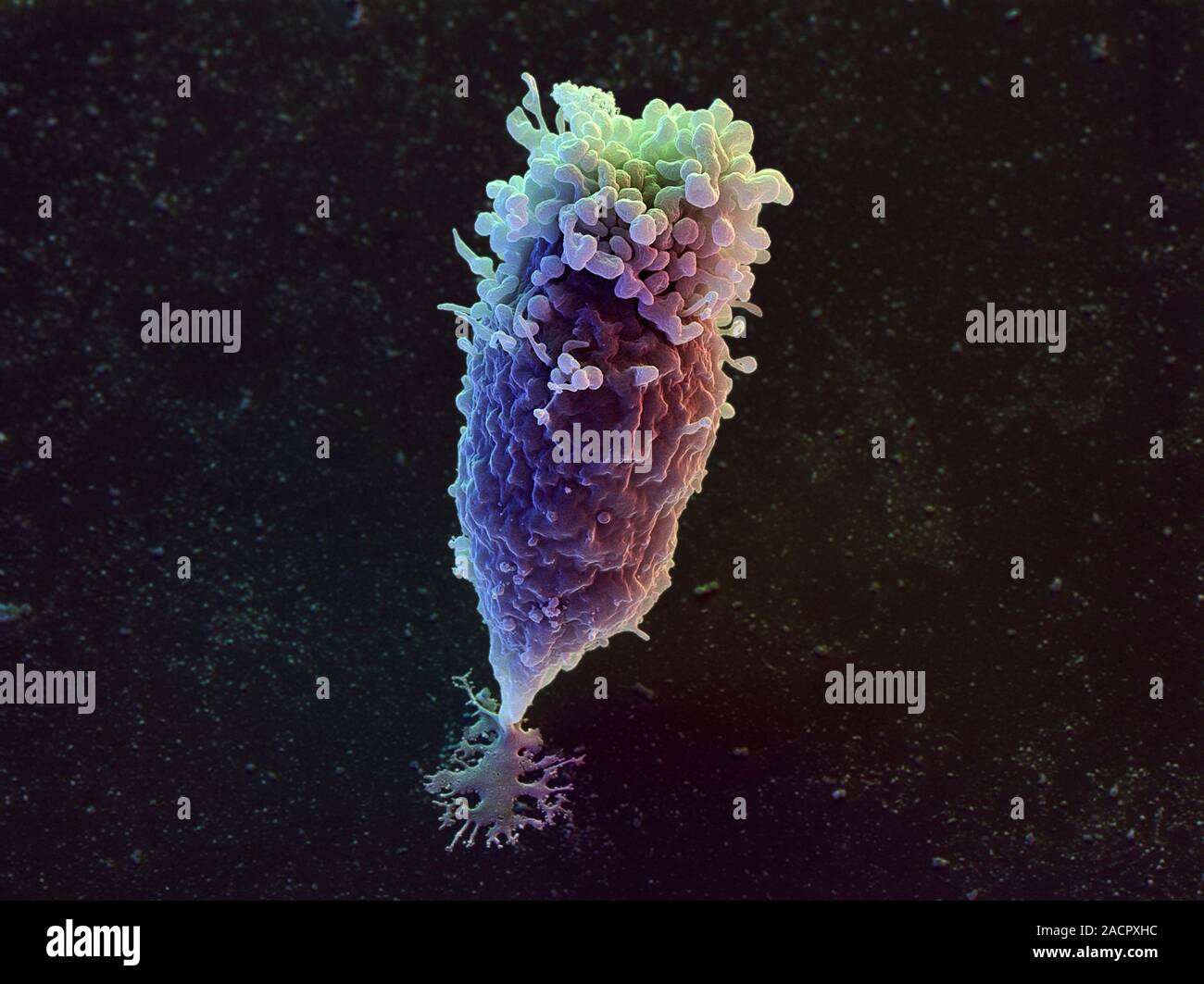 Lymphoblast white blood cell. Coloured scanning electron micrograph ...