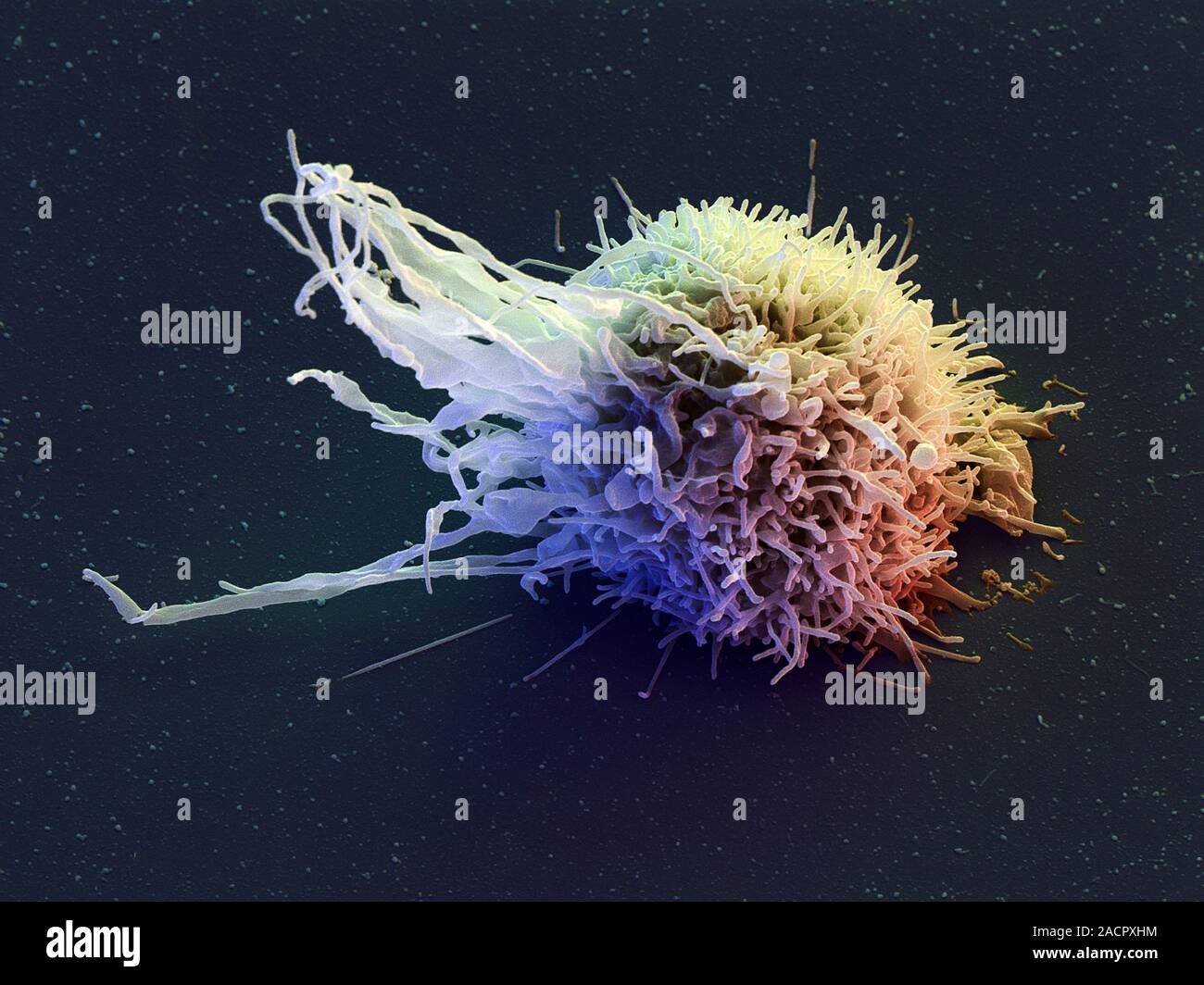 Lymphocyte white blood cell. Coloured scanning electron micrograph (SEM ...
