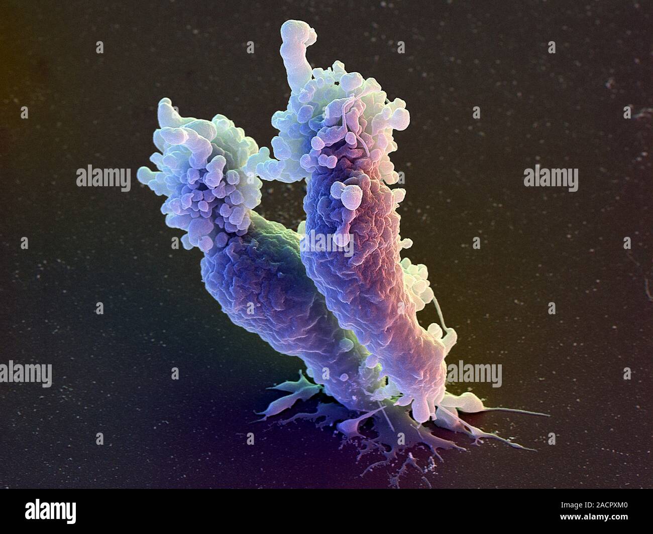 Lymphoblast white blood cells. Coloured scanning electron micrograph ...