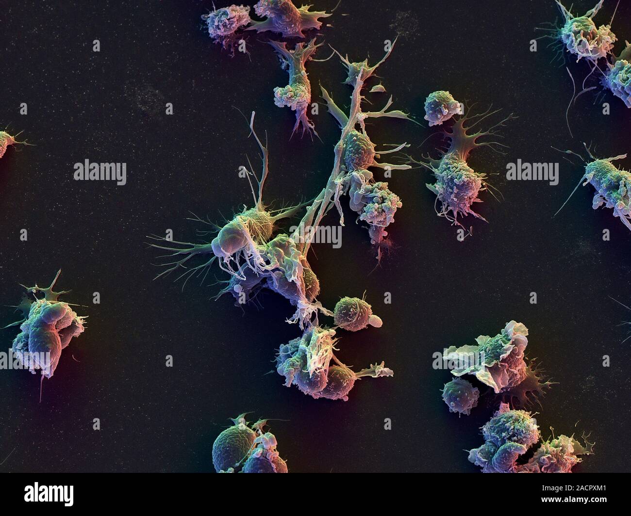 Lymphoblast white blood cells. Coloured scanning electron micrograph ...