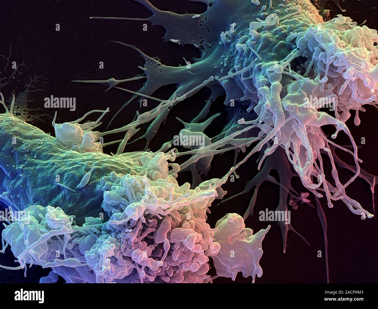 Lymphoblast white blood cells. Coloured scanning electron micrograph ...