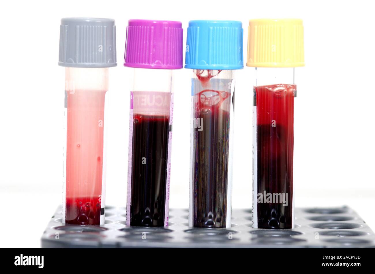 Four blood samples stand in a rack in vacutainer tubes, ready for blood ...