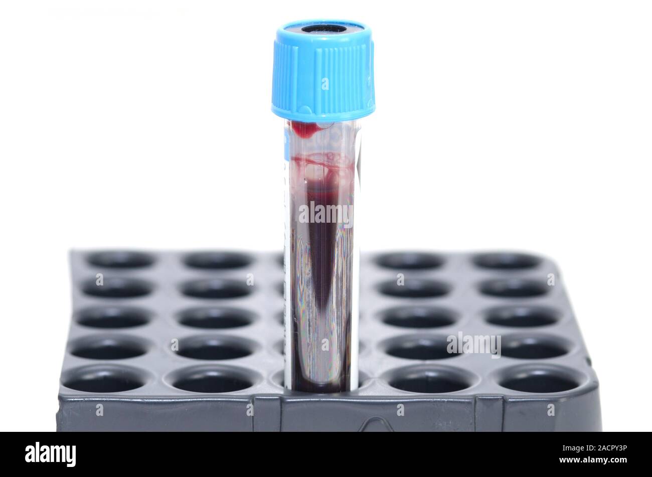 One blood sample stands in a rack in a vacutainer tube, ready for blood ...