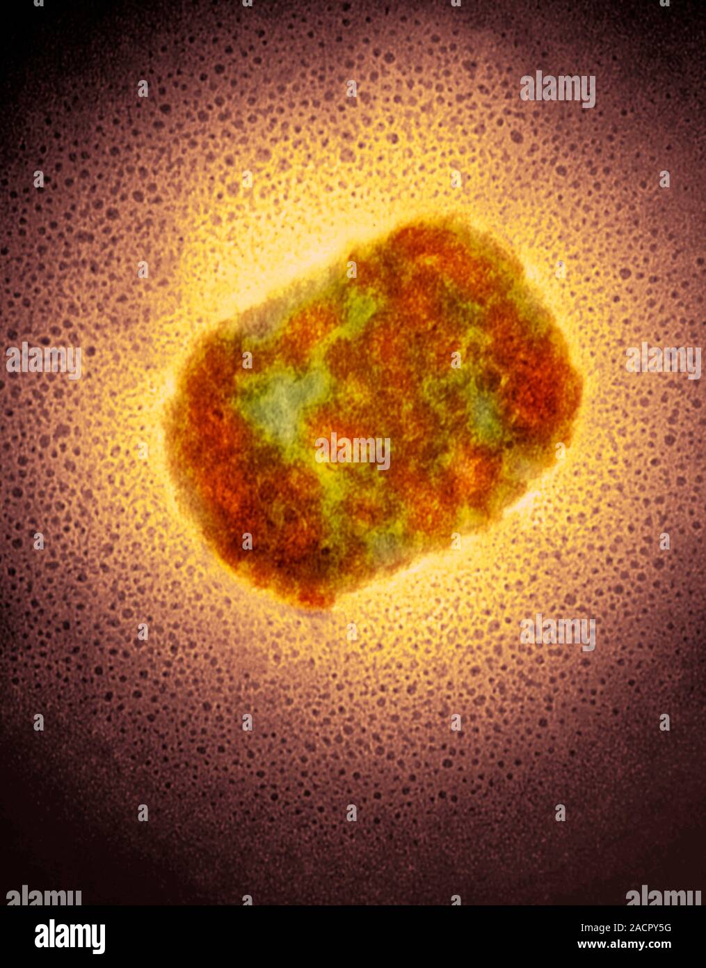 Monkeypox virus (MPV) particle, coloured transmission electron ...