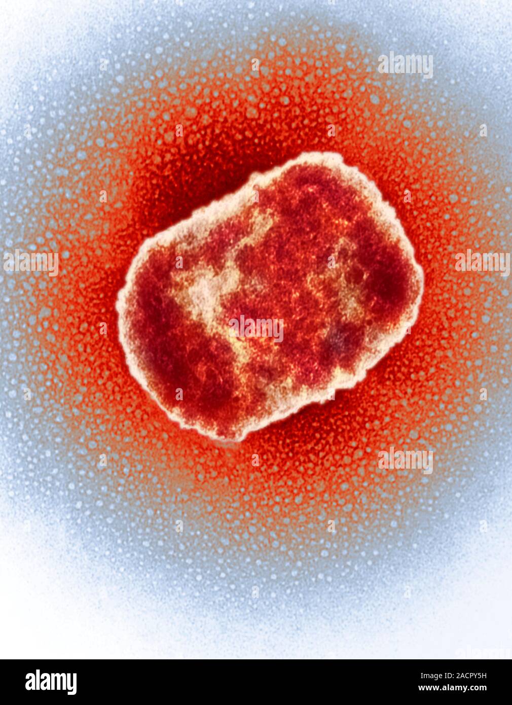 Monkeypox virus (MPV) particle, coloured transmission electron ...
