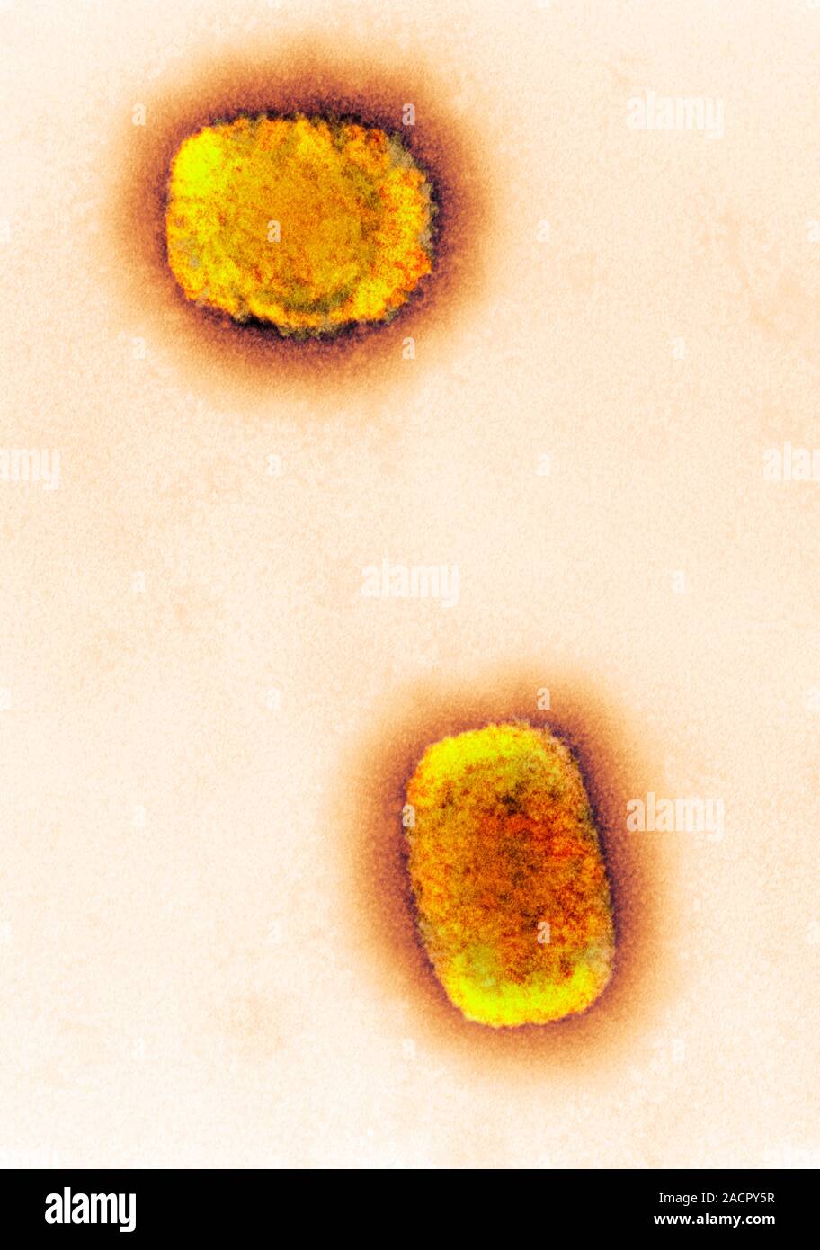 Monkeypox virus (MPV) particles, coloured transmission electron ...