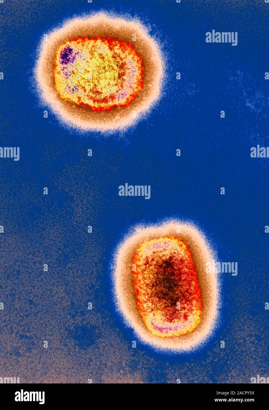 Monkeypox virus (MPV) particles, coloured transmission electron ...